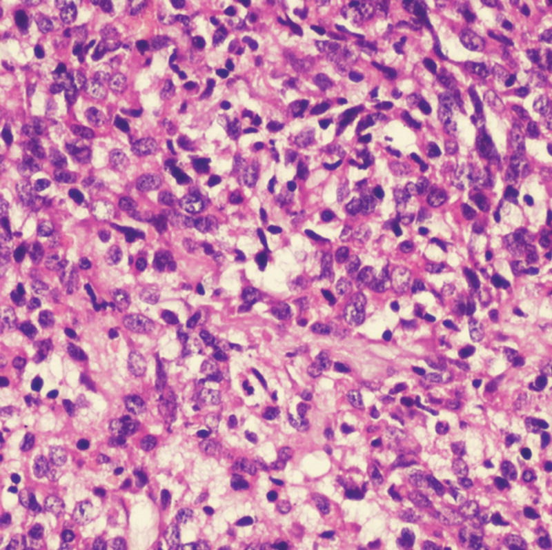 Ematossilina di Mayer | 01HEMM1000 | Histoline